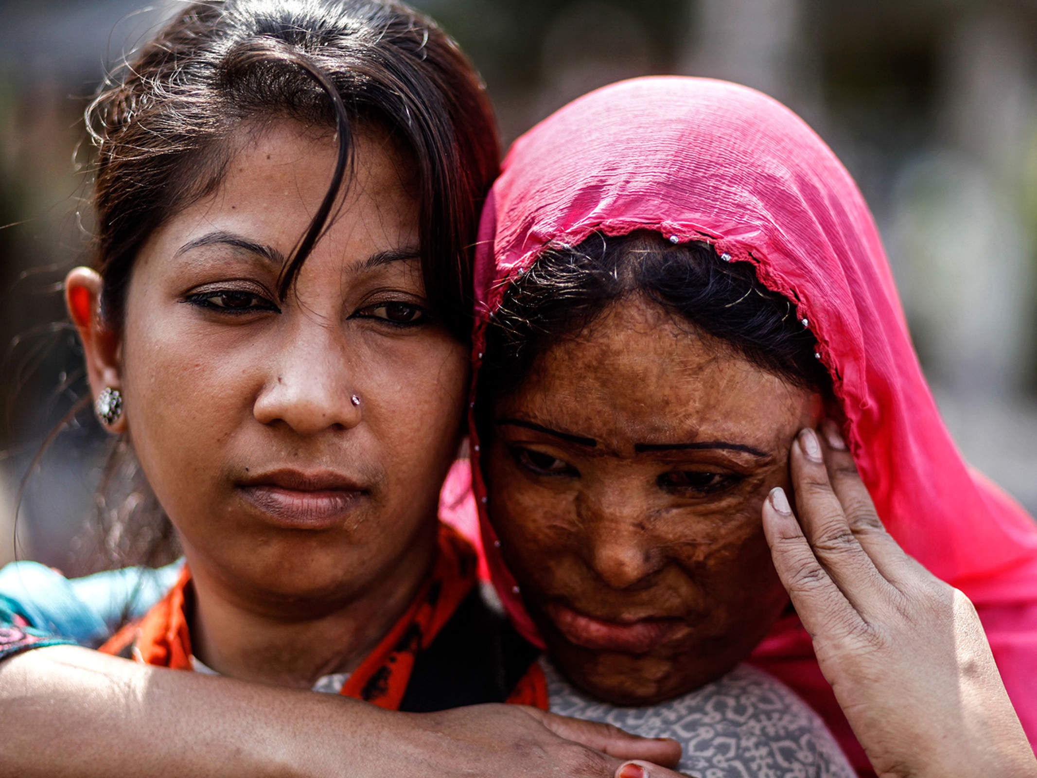 Acid attacks: a horrific crime on the increase worldwide