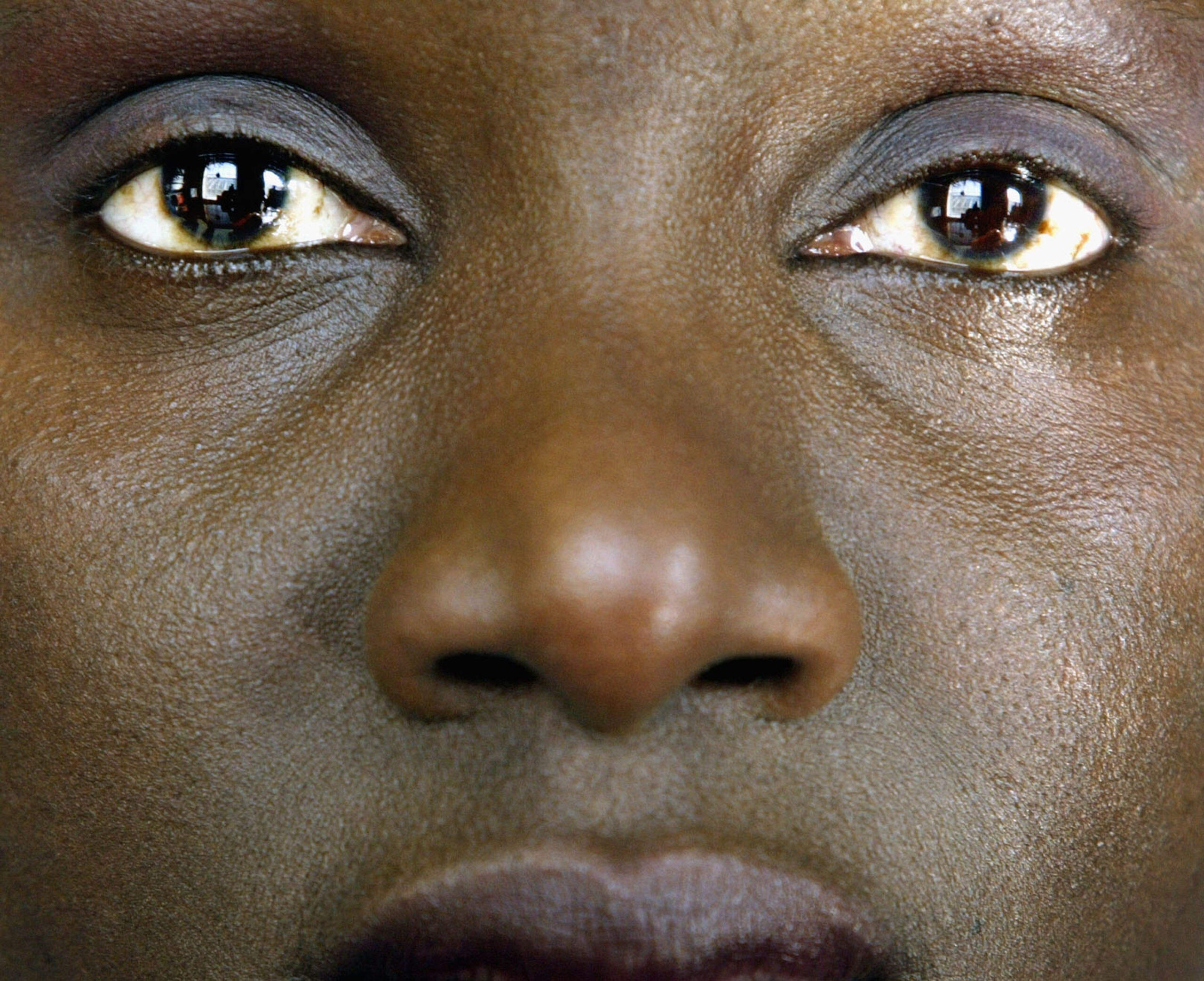 Why did the first prosecution for female genital mutilation take almost ...